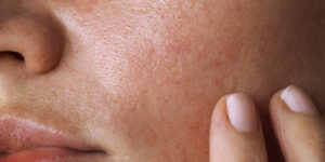 How To Test The pH Of Skin Care Products | Atlas Scientific